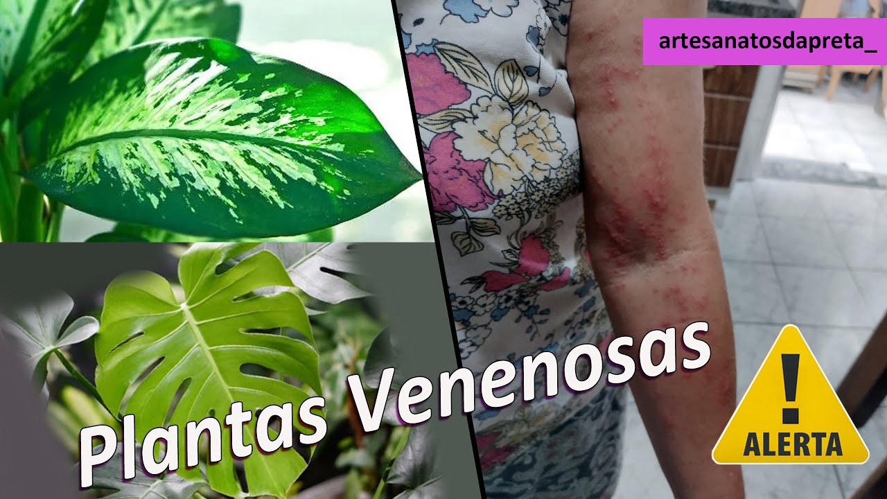 ALERTA ! Plantas venenosas causa FITODERMATOSE - YouTube