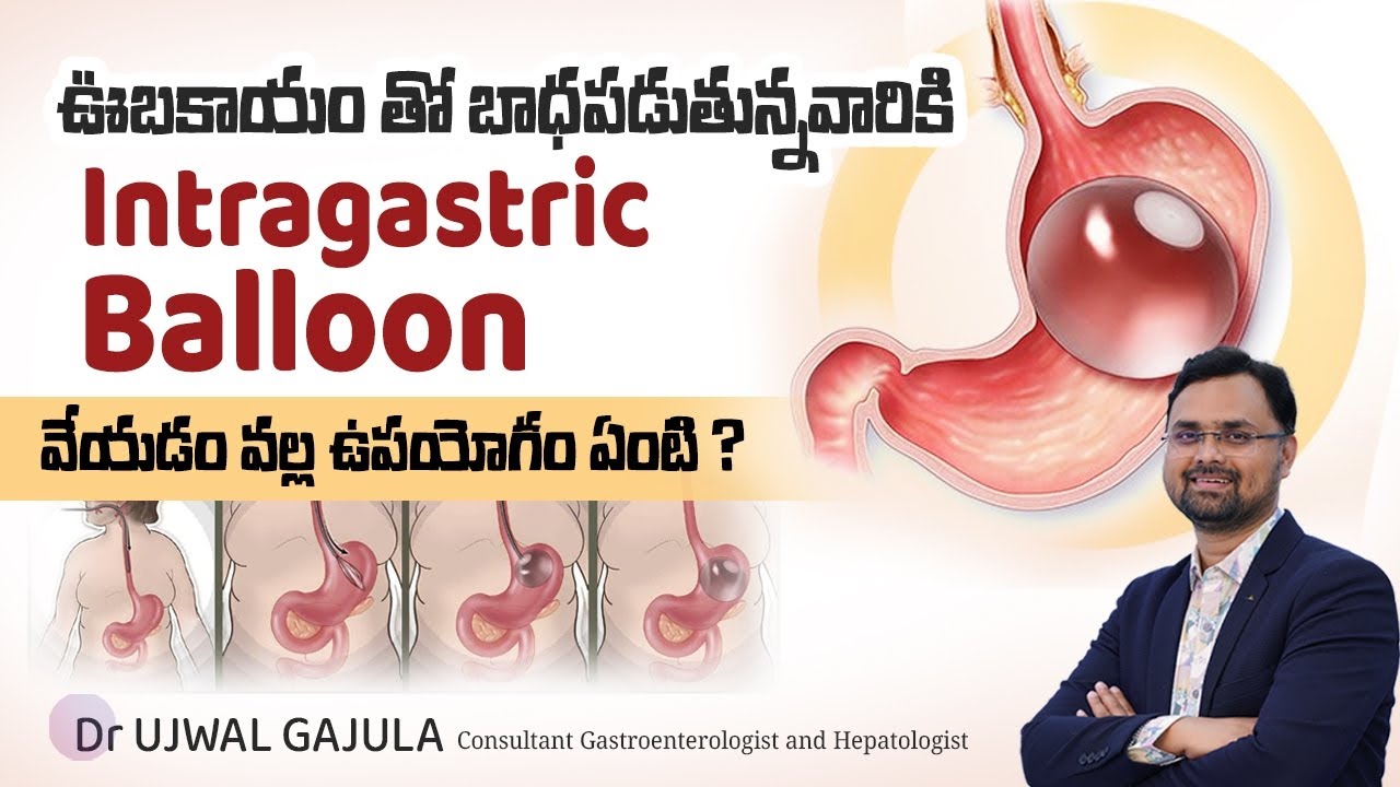 BENEFITS of INSTAGRASTIC balloon | What are the health benefits of ...