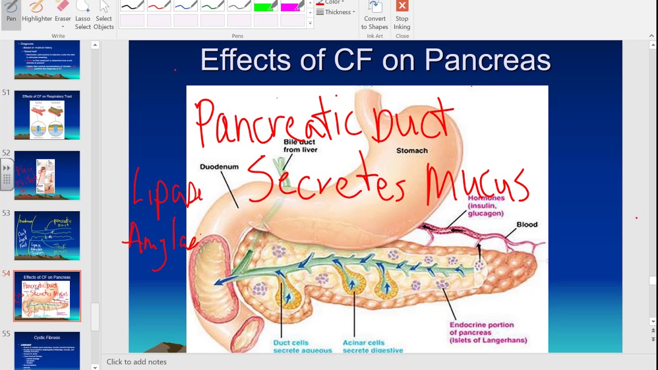 Pathophysiology of Cystic Fibrosis - YouTube