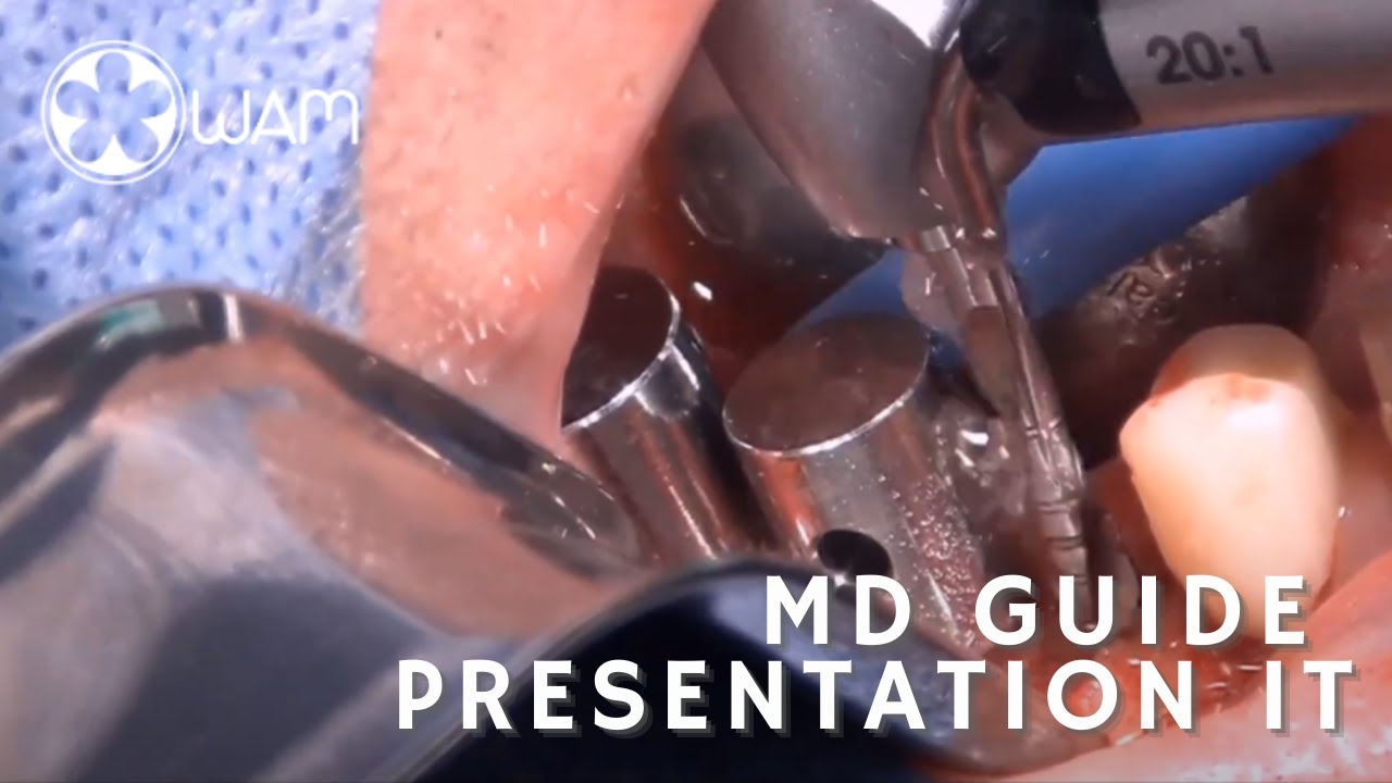 MD Guide présentation IT - WAM - matériel dentaire - YouTube