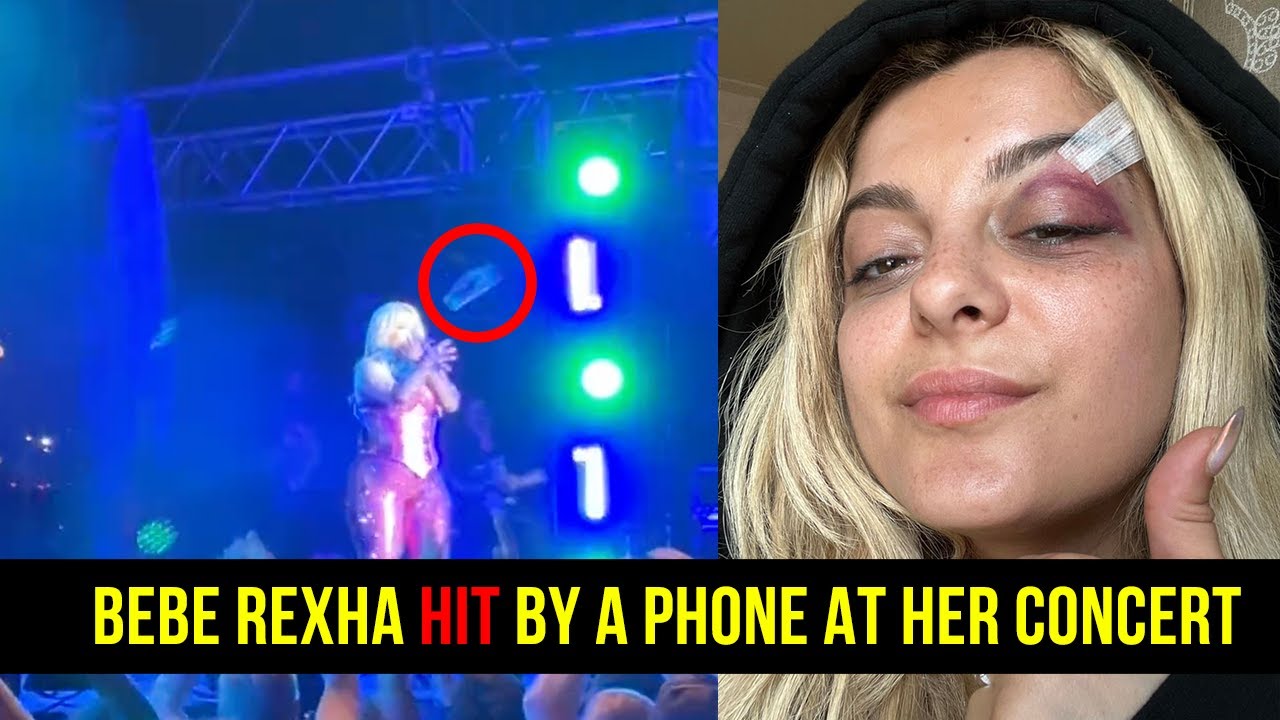 Bebe Rexha shows her injury after being hit by a phone at her concert ...