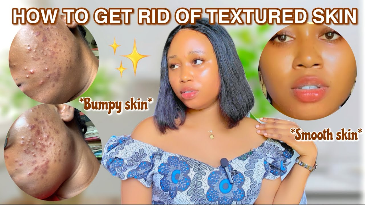 HOW TO GET RID OF TEXTURED SKIN: A skincare routine for a Smooth and ...