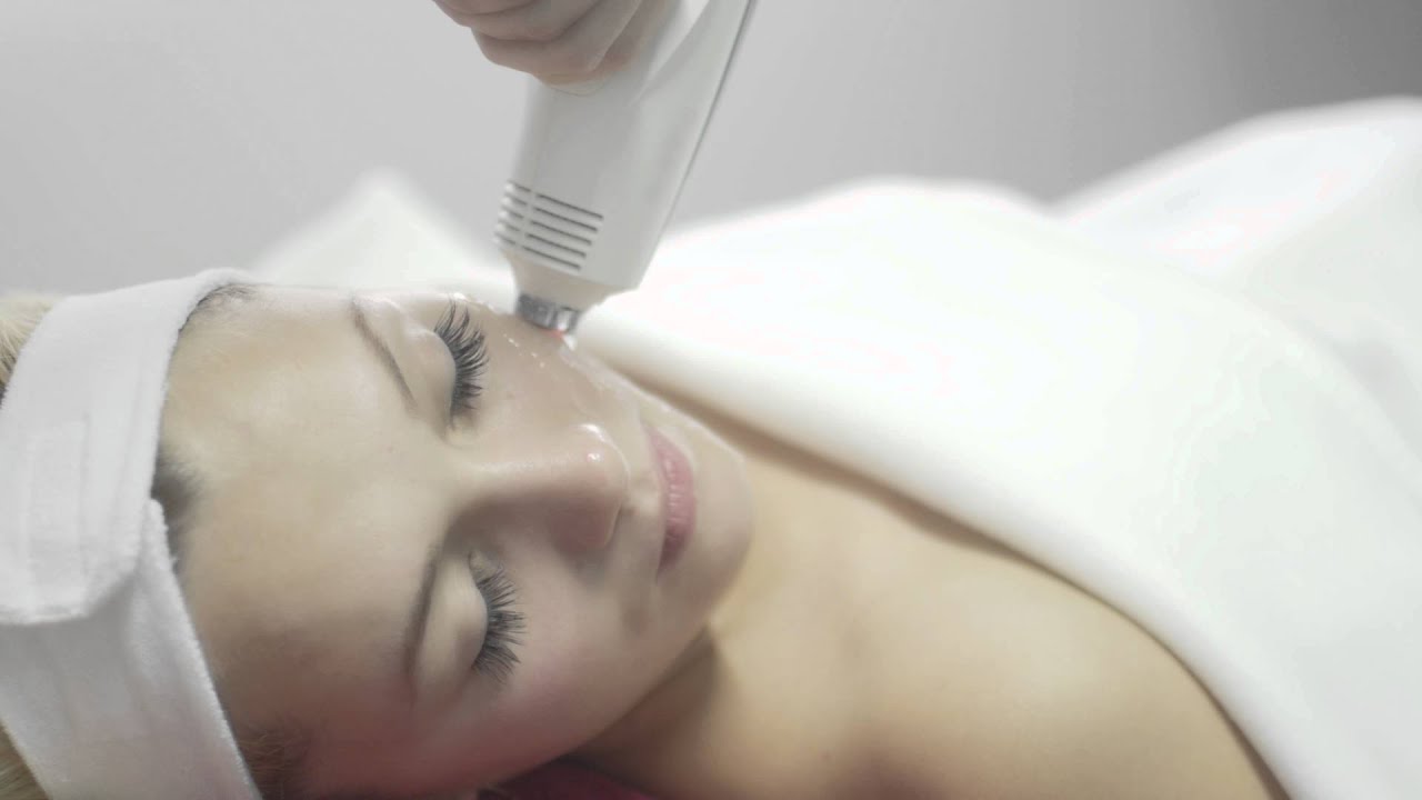 Traitement Laser Médecine Esthétique Nantes Youtube