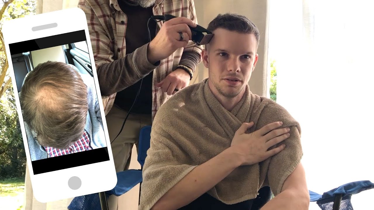 BALDING IN MY 20's - Tackling My Biggest Insecurity *Shaving off My ...