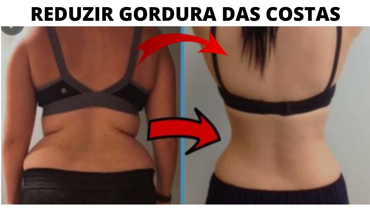 Como Perder Gordura Das Costas Com Exercicios Para Perder Gordura Nas