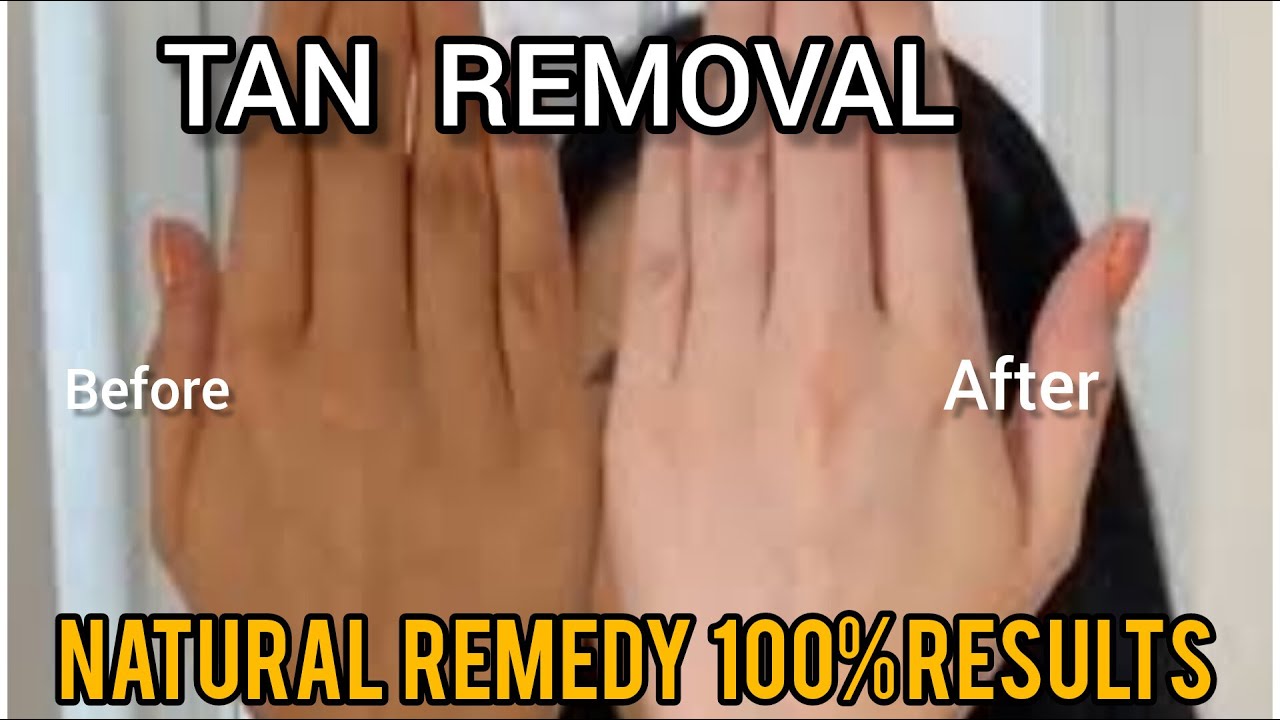 Summer main Kaisa hataye Skin Tanning | Tan Removal Home Remedies ...