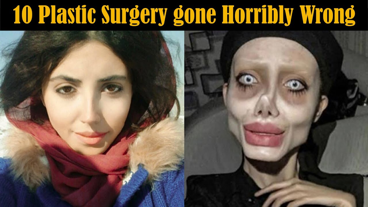 10 celebrities Plastic Surgery gone Horribly Wrong - YouTube