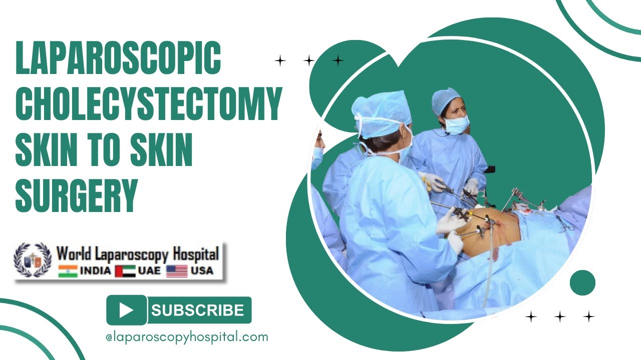 Laparoscopic Cholecystectomy — Skin to Skin Surgery | Step-by-Step ...