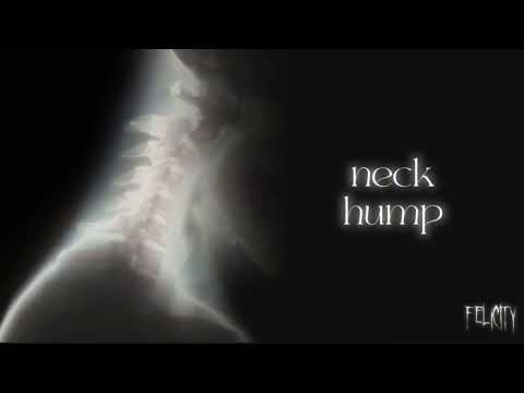 neck hump | ense hörgücünden kurtul, mükemmel boyun, omurga ve dik duruş subliminal
