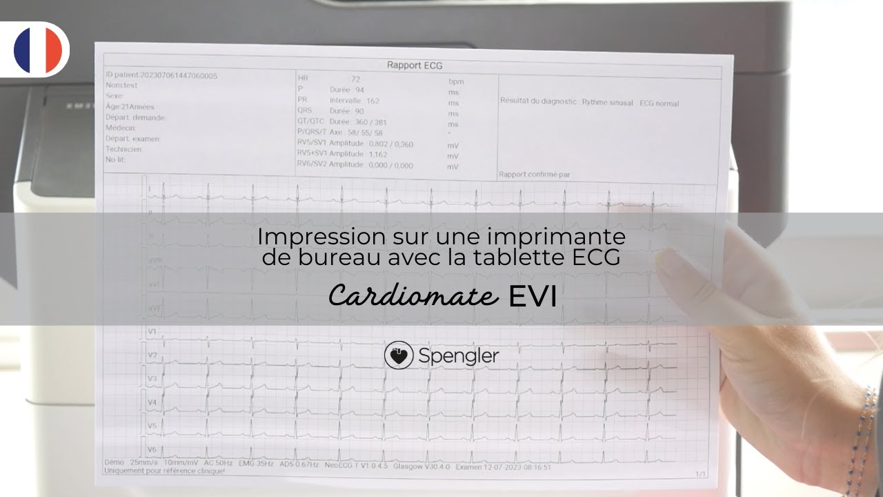 Comment lancer l'impression d'un ECG sur une imprimante de bureau avec ...
