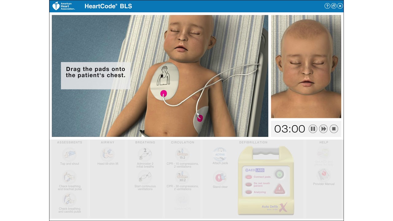 Infant BLS - One Rescuer - YouTube