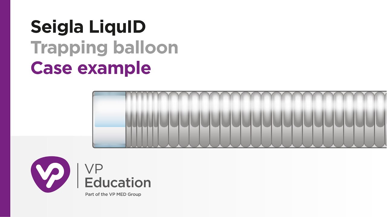 Seigla LiquID Trapping balloon Case example - YouTube