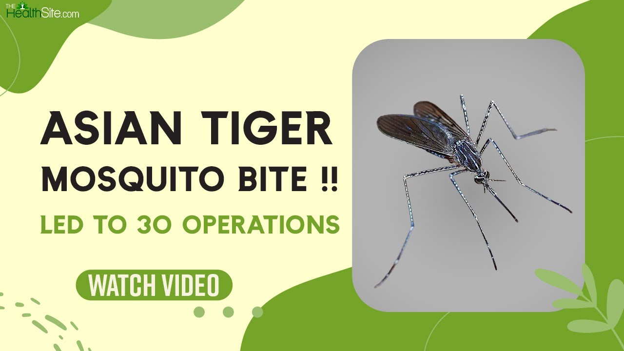 Tiger Mosquitoes Bites