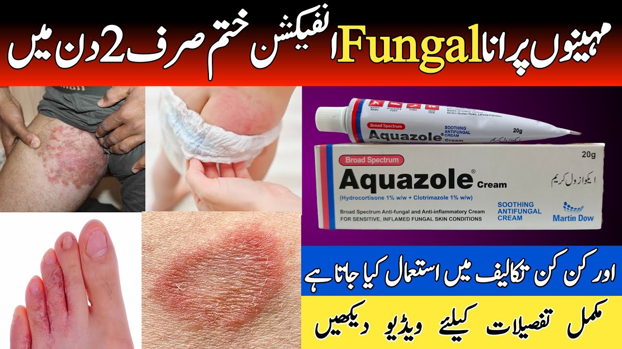 Aquazole Cream Uses in Urdu | Aquazole cream review | Fungal infection ...