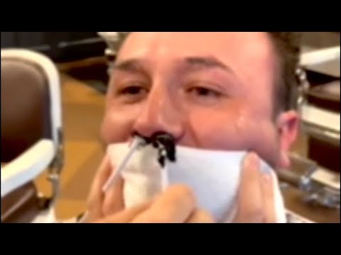 Oh No! Wax sticks get stuck in Dustin Helms nose at the barbershop! “I ...