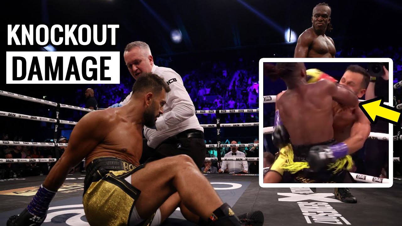 KSI Illegal Elbow KNOCKOUT vs Joe Fournier - Doctor Explains KSI KO Of ...