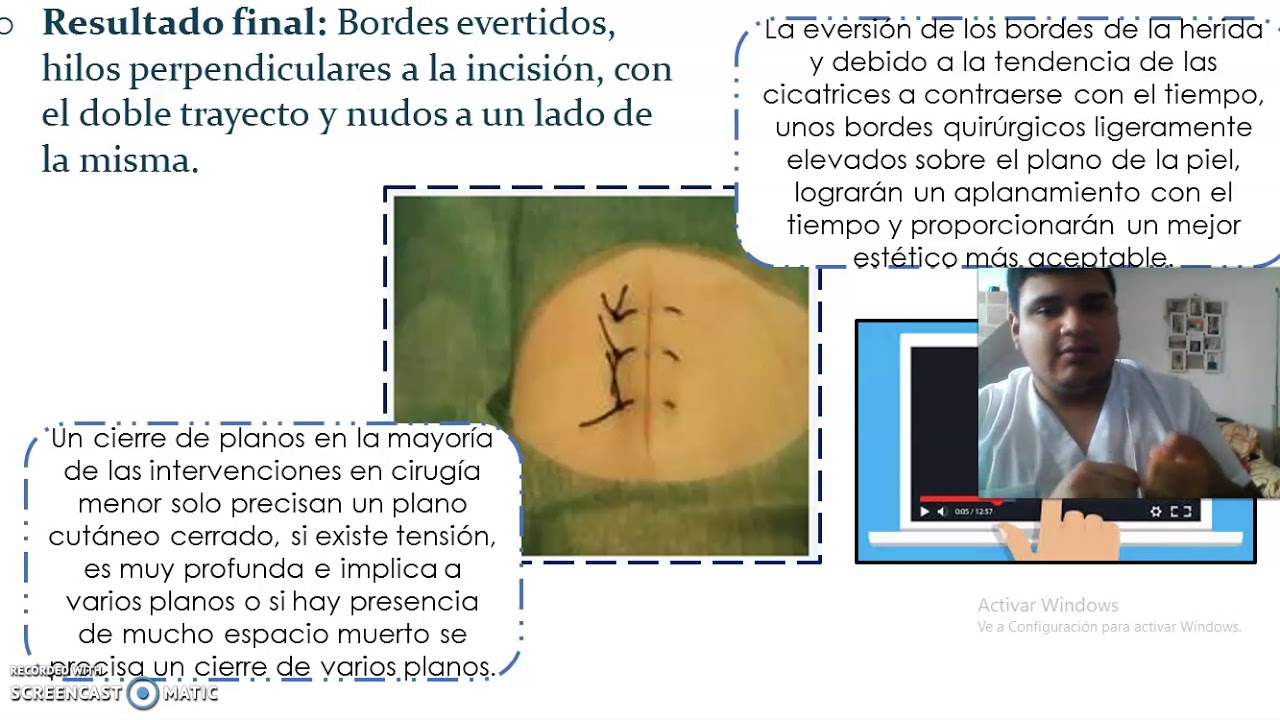 SUTURA PRACTICA-Punto Colchonero Vertical-Subdérmico Continuo - YouTube