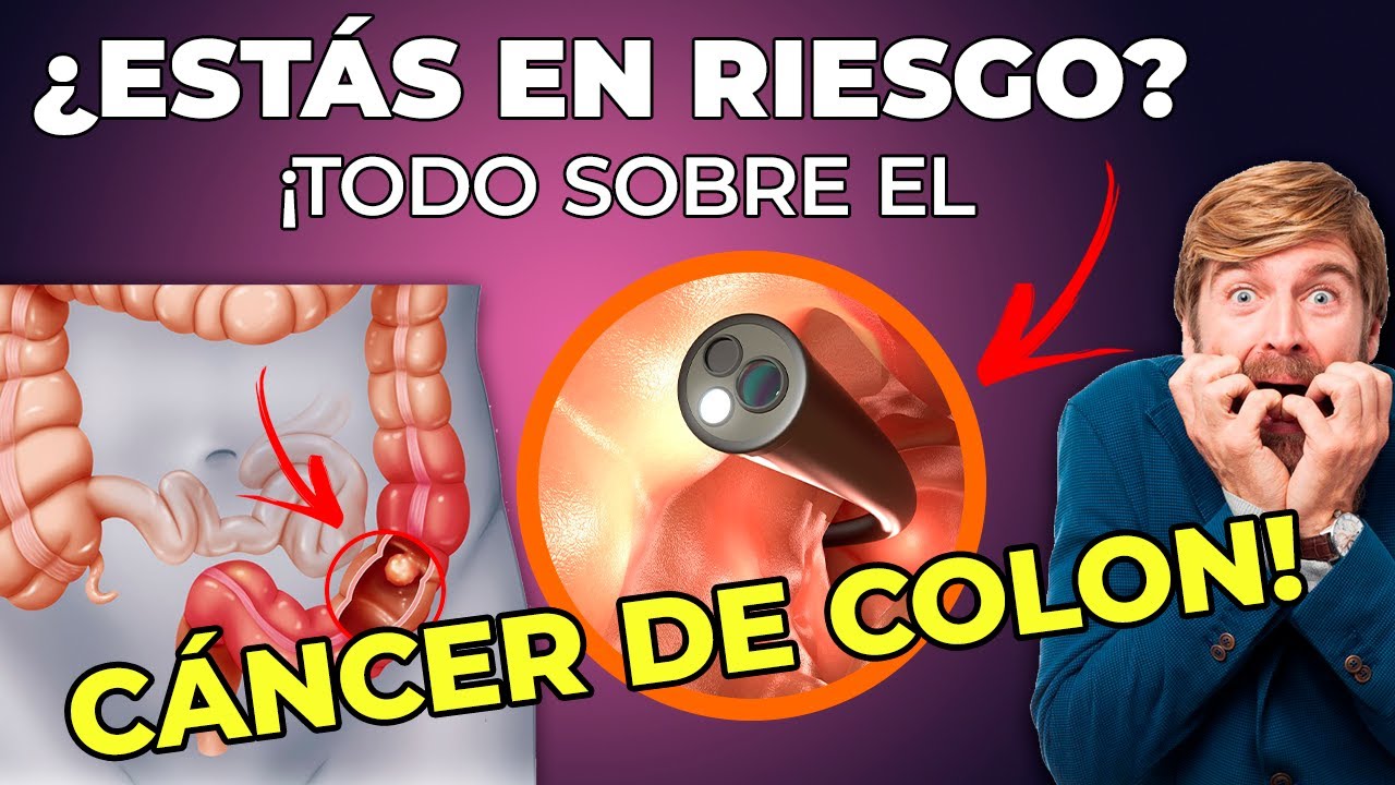 Enemigo invisible: Detección de cáncer de colon - YouTube