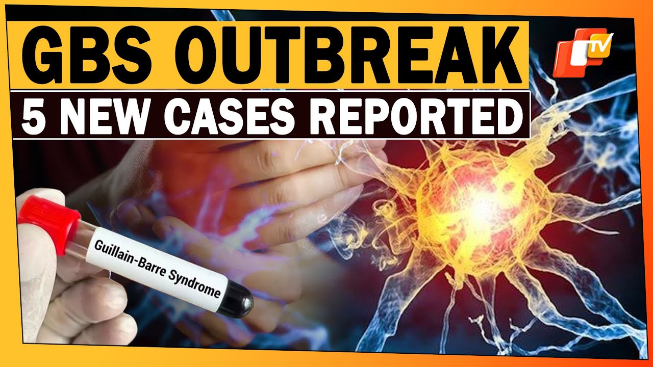 GBS Outbreak In Maharashtra: 5 New Suspected GBS Cases, Toll Rises To ...