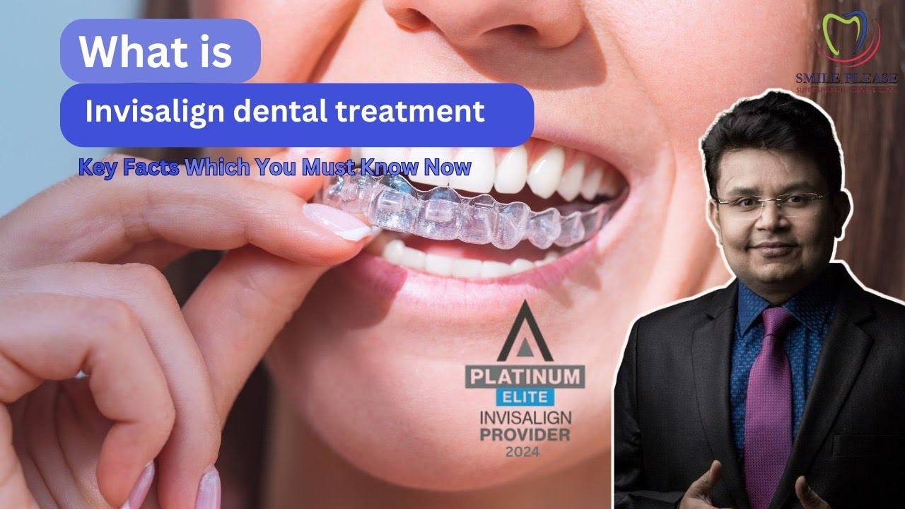 What is Invisalign?? Discover the World of Invisalign! - YouTube
