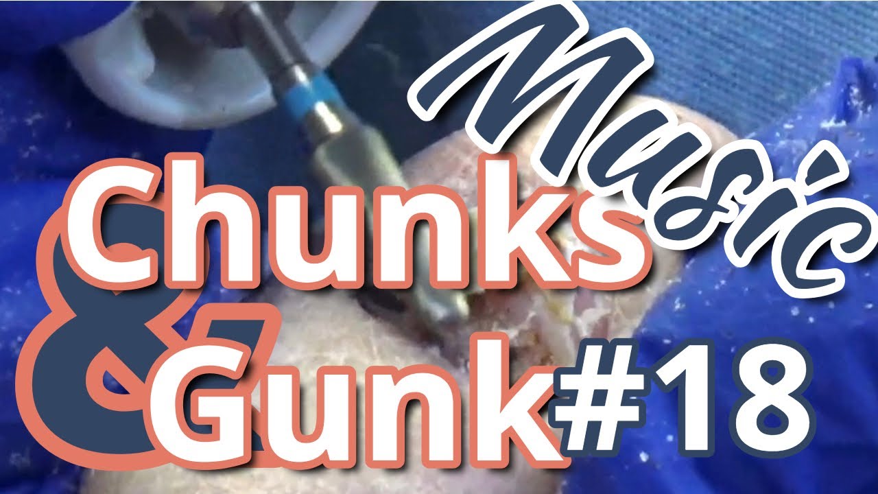 Chunks and Gunk #18 Music (2022) - YouTube