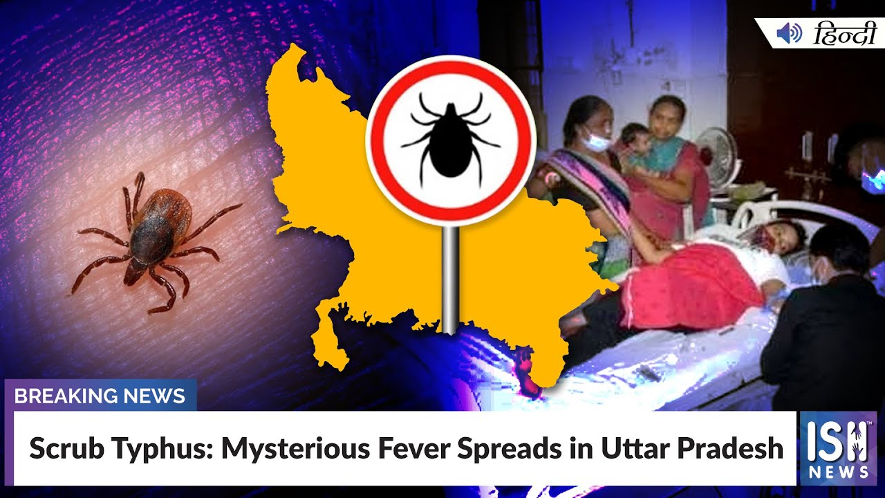 Scrub Typhus: Mysterious Fever Spreads in Uttar Pradesh - YouTube