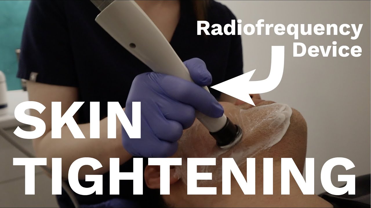 The BEST devices for Skin Tightening | Dr Davin Lim - YouTube