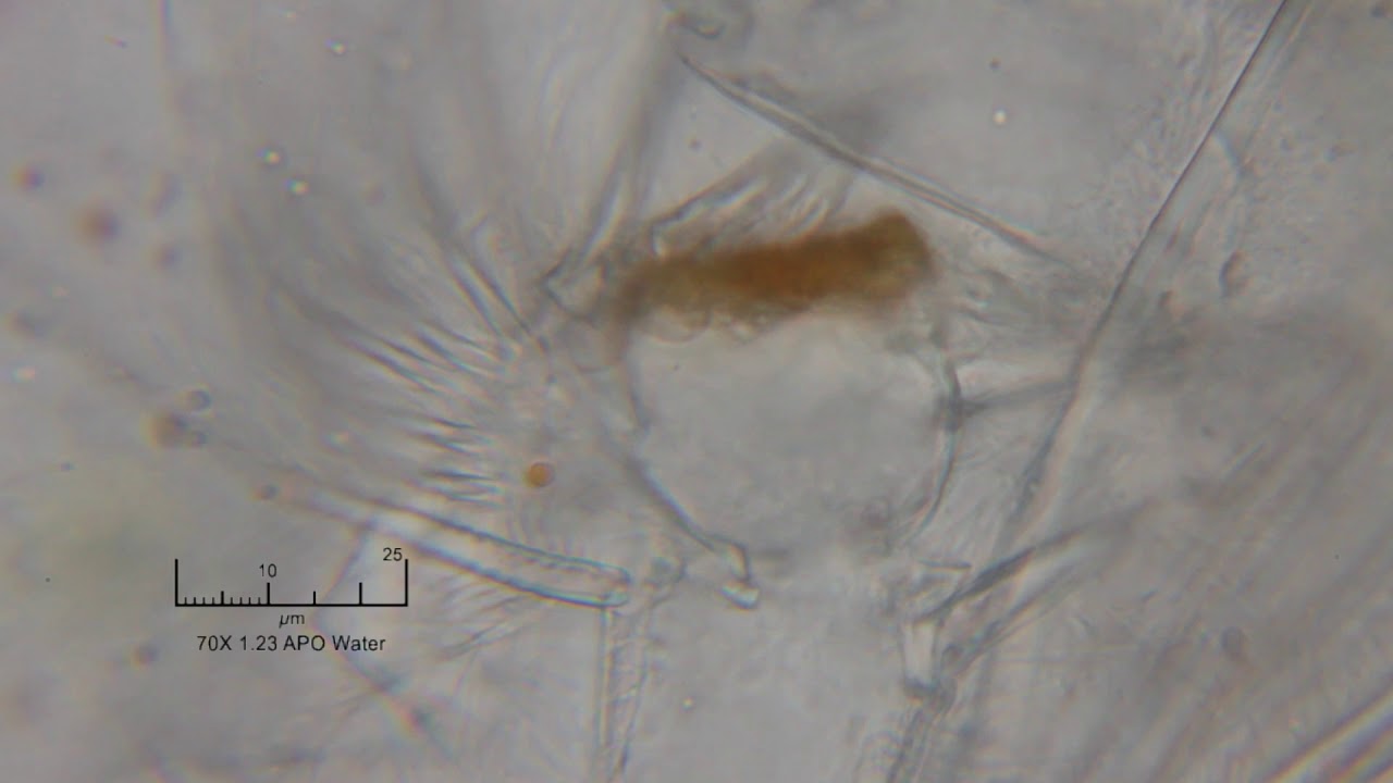 Pond Life Through the Microscope: Copepods 3 - YouTube