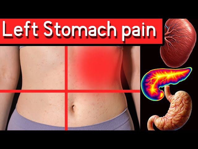 Upper Left Abdominal Pain Left Upper Quadrant Abdominal Pain WikEM