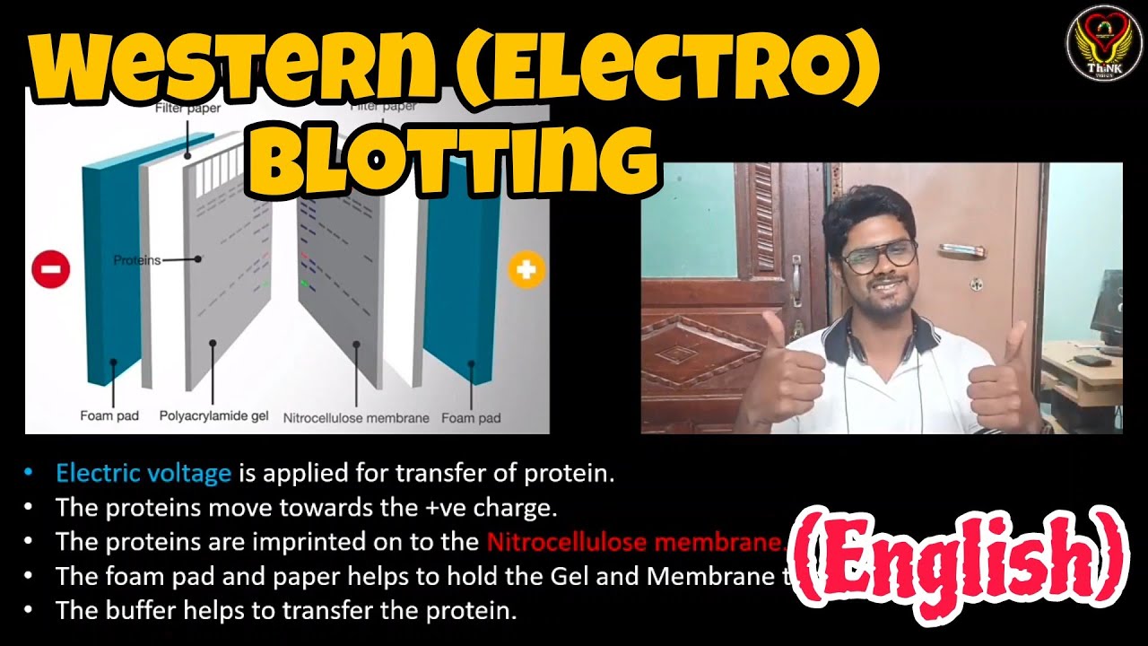 Western / Electro Blotting & Eastern Blotting (English) | Protein ...