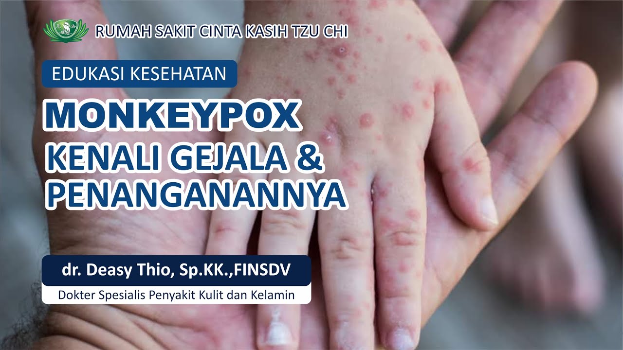Waspada Monkeypox atau Cacar Monyet - YouTube