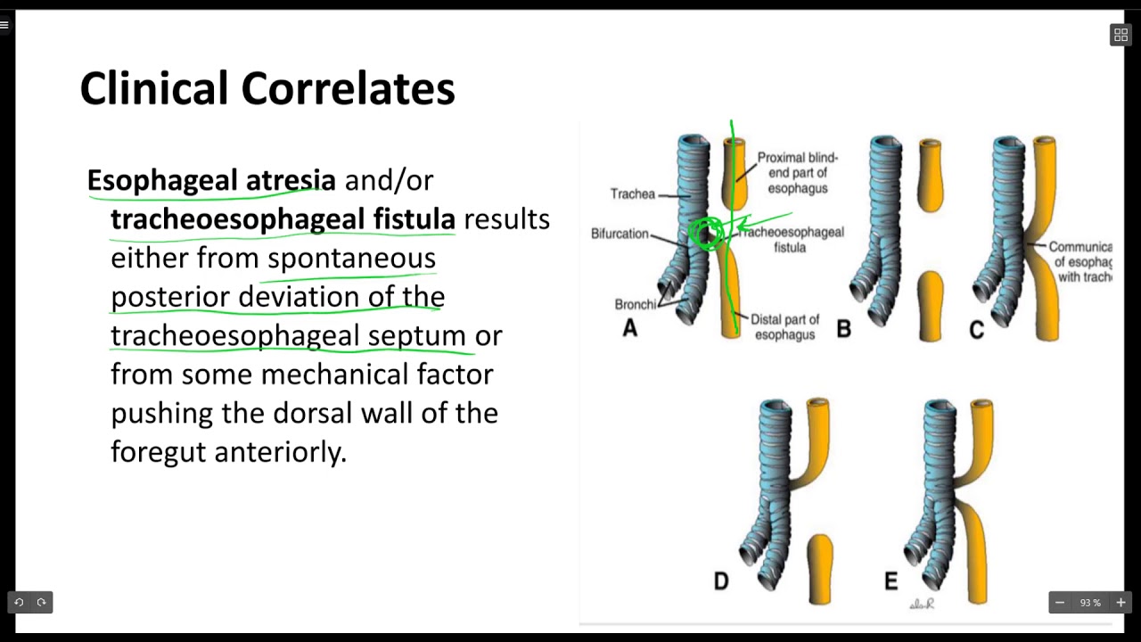 Development of digestive system part 1 - YouTube
