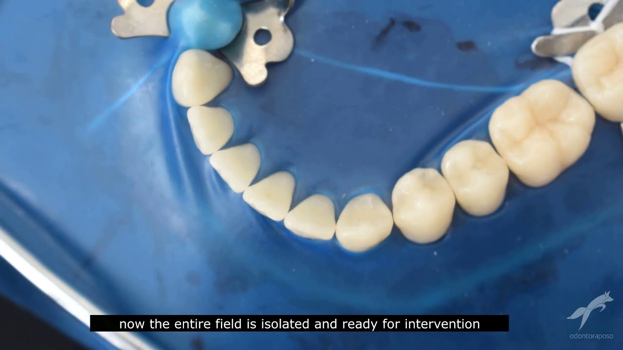 Isolamento Absoluto - Odontologia - YouTube
