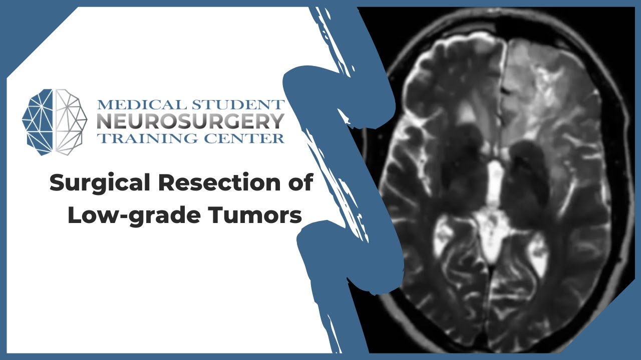 Surgical Resection of Low-grade Tumors - YouTube