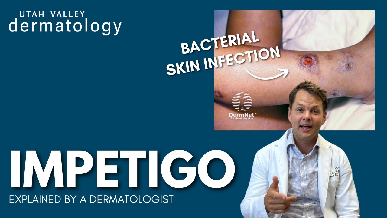 Honey Encrusted Sores? Might Be Impetigo | Utah Valley Dermatology ...