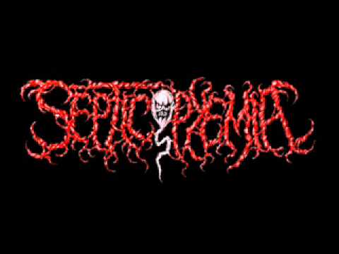 Septicopyemia - Diphallus (Chordee of Bifid Penis) - YouTube