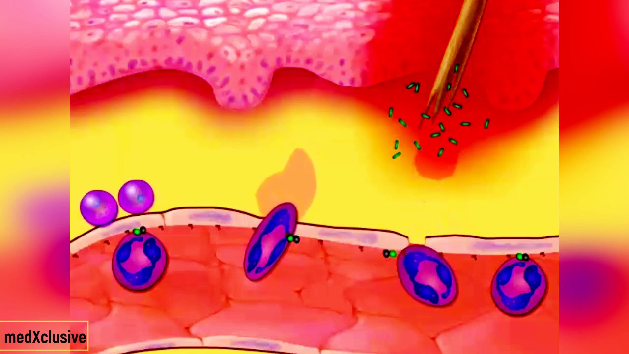 Inflammatory Response [Introduction] - YouTube