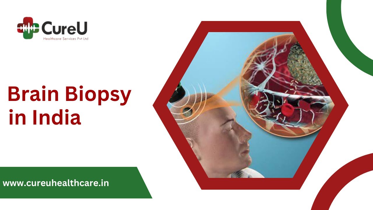 Brain Biopsy : Understanding the Procedure in India | Expert Insights ...