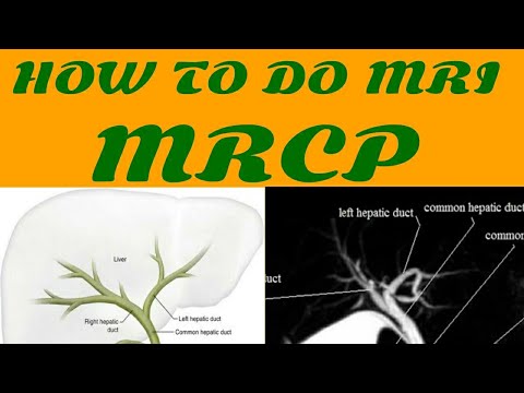 HOW TO DO MRI MRCP - YouTube