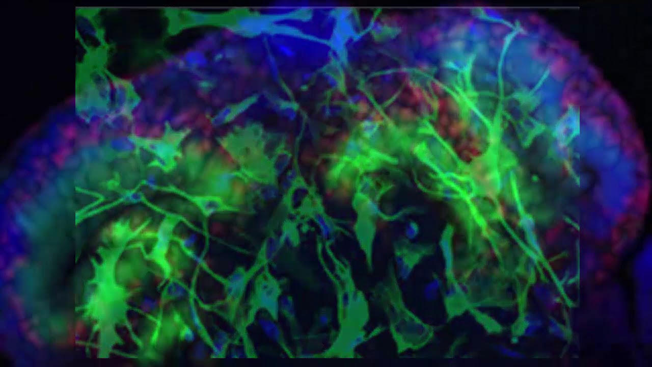 Astrocytes Glial Cells Slide Show - YouTube