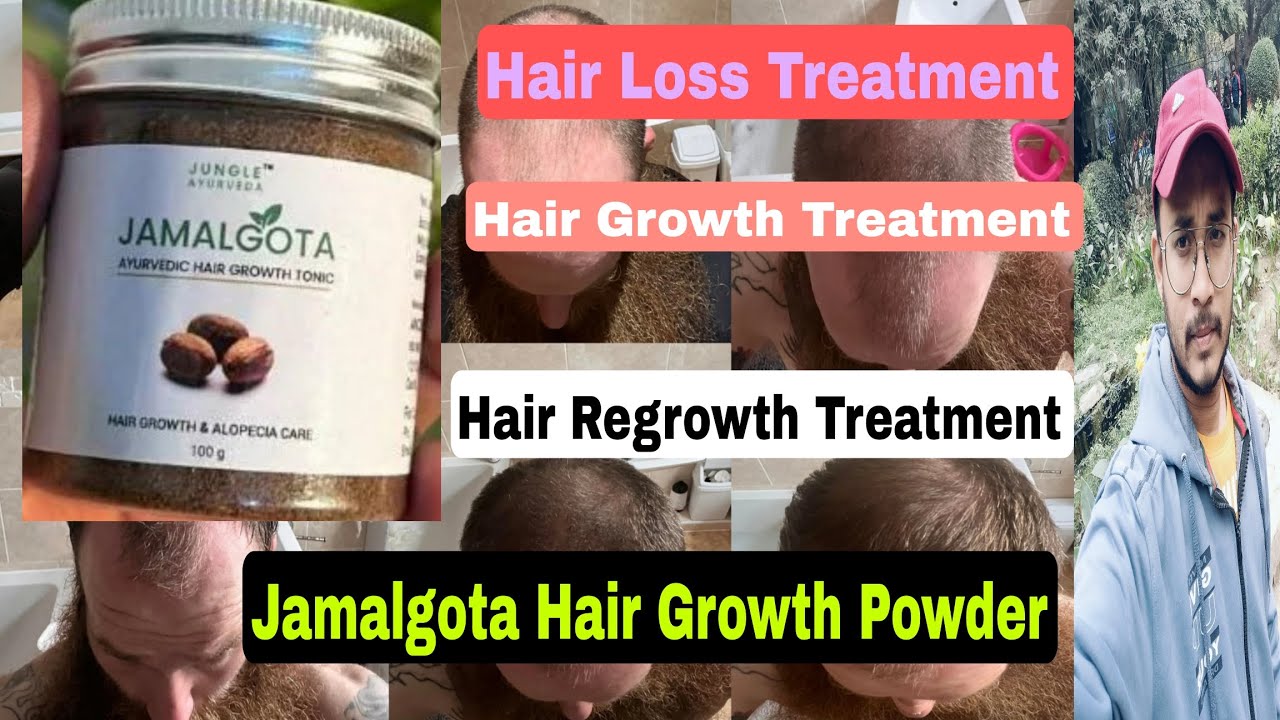 Jamalgota Hair Growth Powder Review - YouTube