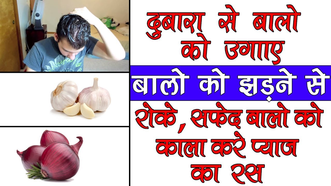 सफेद बालों को काला करें प्याज़ का रस Safed Balon Ke Liye Pyaz Ka Ras ...