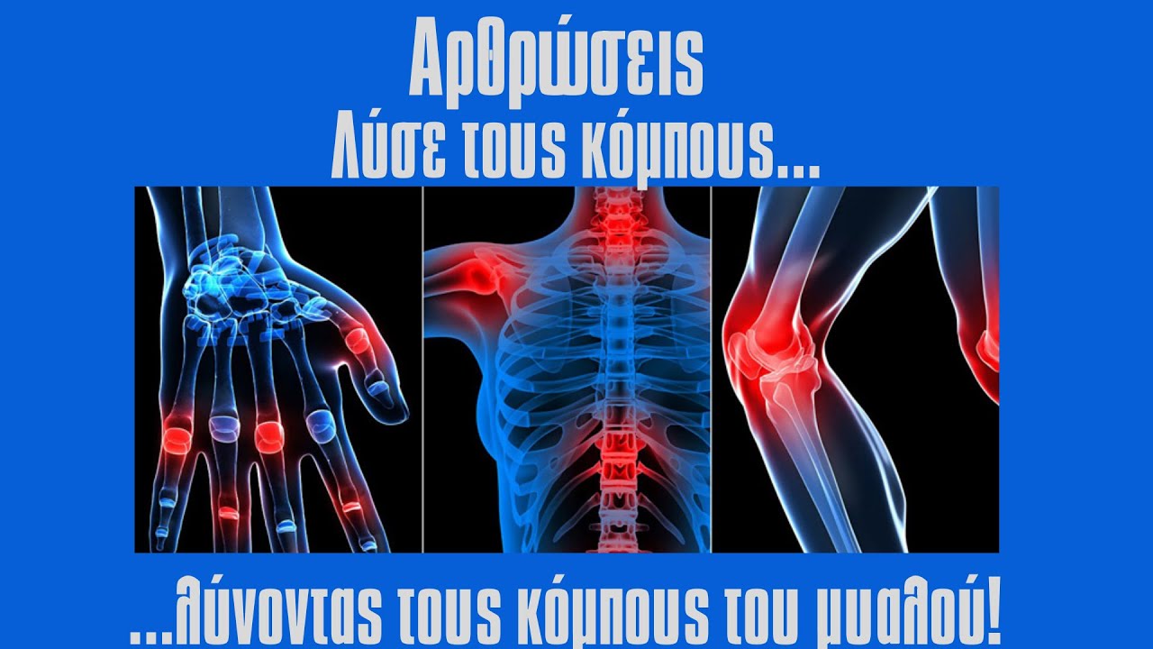 Αρθριτικά-Ρευματισμοί-Ρευματοειδής Αρθρίτιδα και Θεραπεία - YouTube