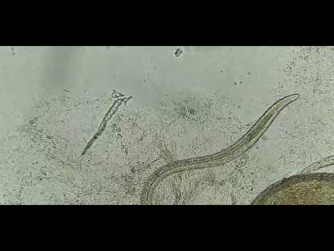 Parasit Camallanus sp di organ hati ikan cupang - YouTube