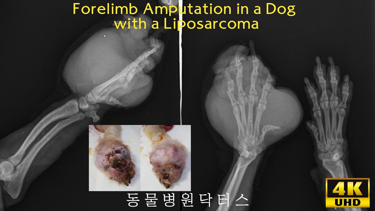 Forelimb Amputation in a Dog with a Liposarcoma 지방육종 전지절단수술 - YouTube