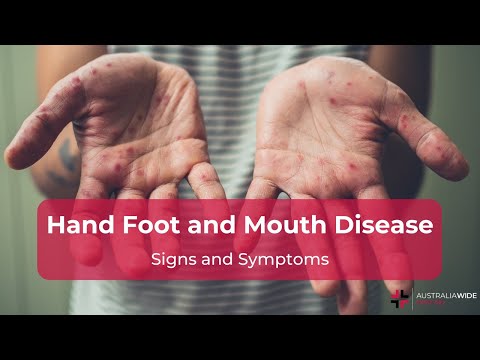 Is Diarrhea A Symptom Of Hand Foot And Mouth Disease
