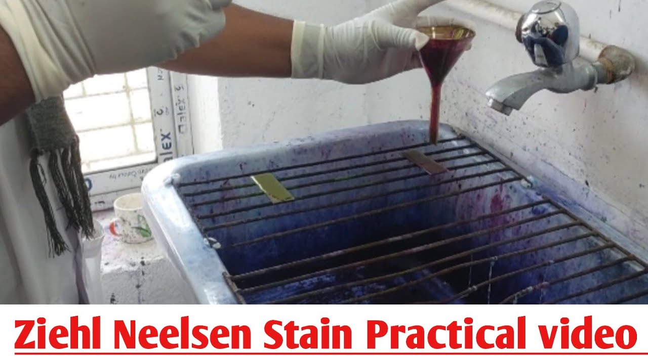 Ziehl Neelsen Stain (Z-N Stain) || Acid Fast Staining || ZN Stain ...