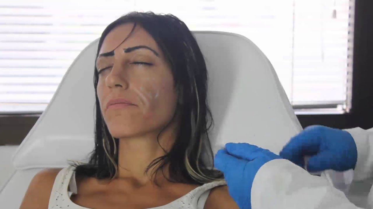 Crystalys Luminera - patient2 - YouTube