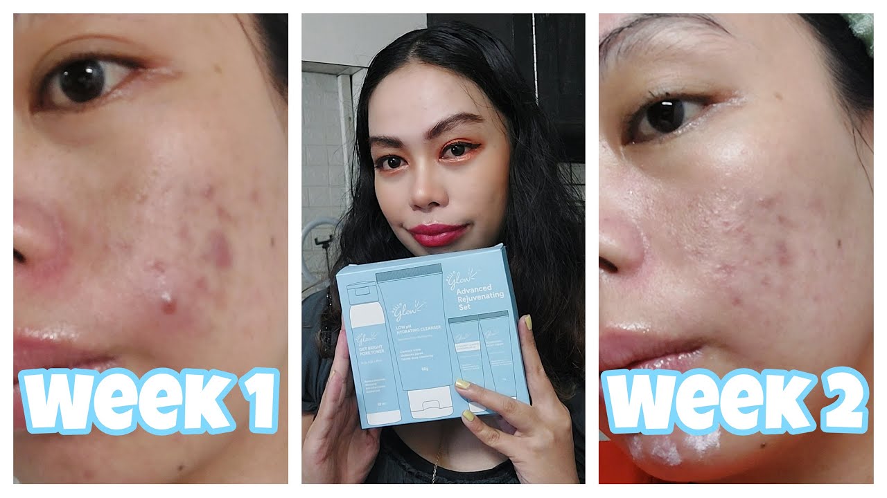 I Tried The Hello Glow Advanced Rejuvenating Set for 3 Weeks: Here’s ...