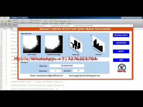 Breast Cancer Detection Using Image Processing | With Source Code ...